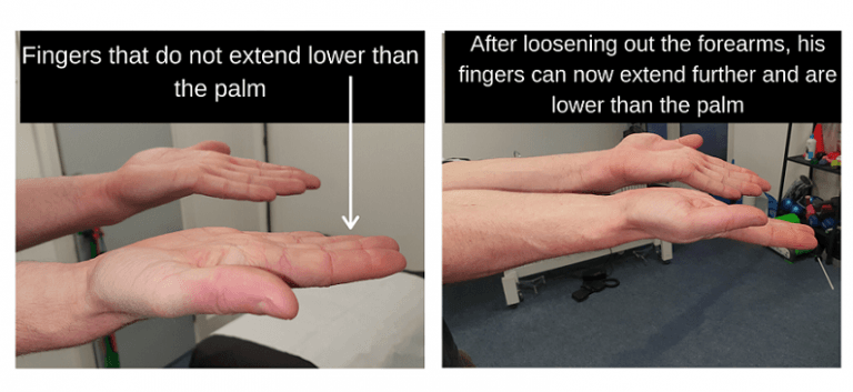 Rock climbing: Flexible Fingers and Wrists - Maple Physical Therapy Clinic